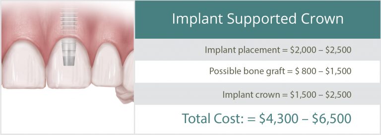 Dental Implants Are More Cost Effective - The Dental Implant Guide